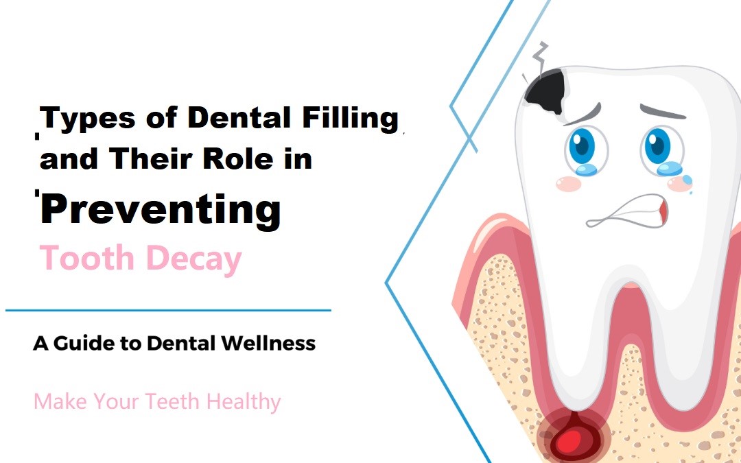 Types of Dental Filling and Their Role in Preventing Tooth Decay ...