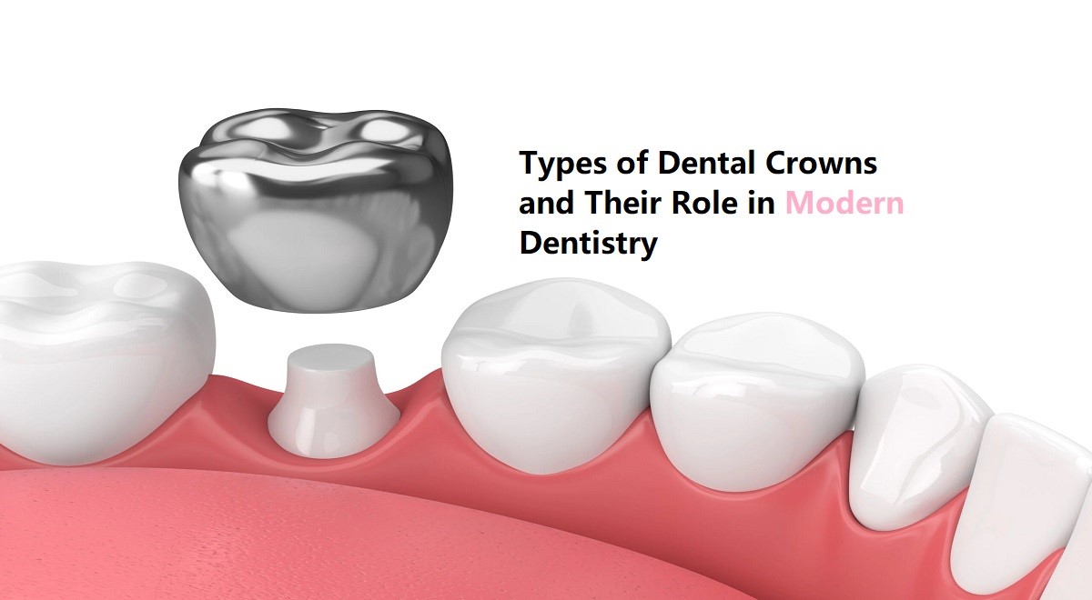 Types of Dental Crowns and Their Role in Modern Dentistry | Smile Cove ...